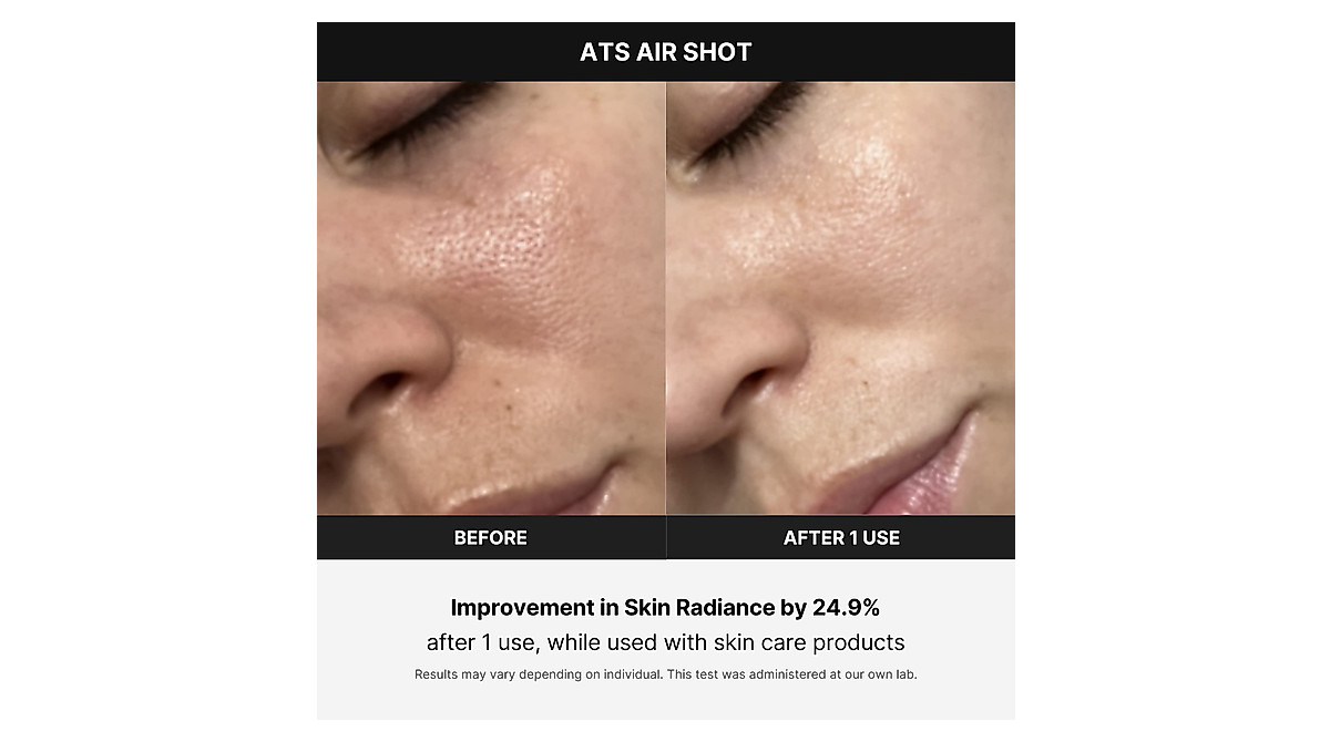 Medicube Age-R ATS Air Shot: Microneedling Solution