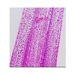 Onion Root Tips Mitosis Microscope Slides Set, 25PCS Pack Slides Show Plant Mitosis for Biology Science Class (25 Count)
