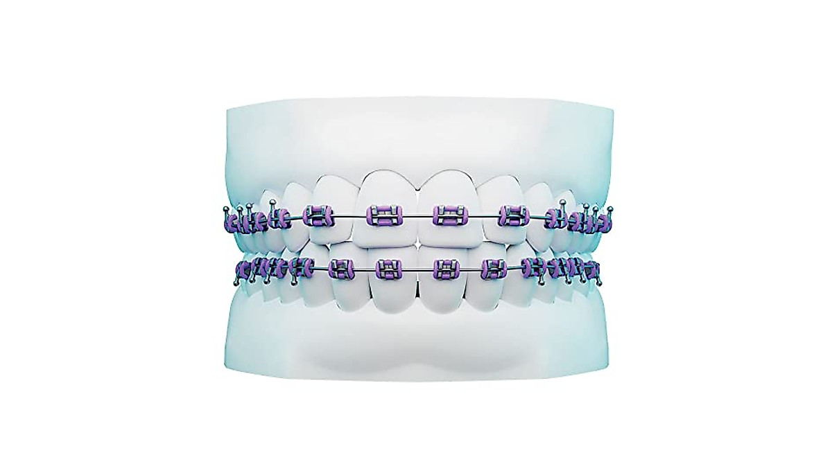 PlaqueHD Toothpaste - Gentle Whitening & Fresh Breath