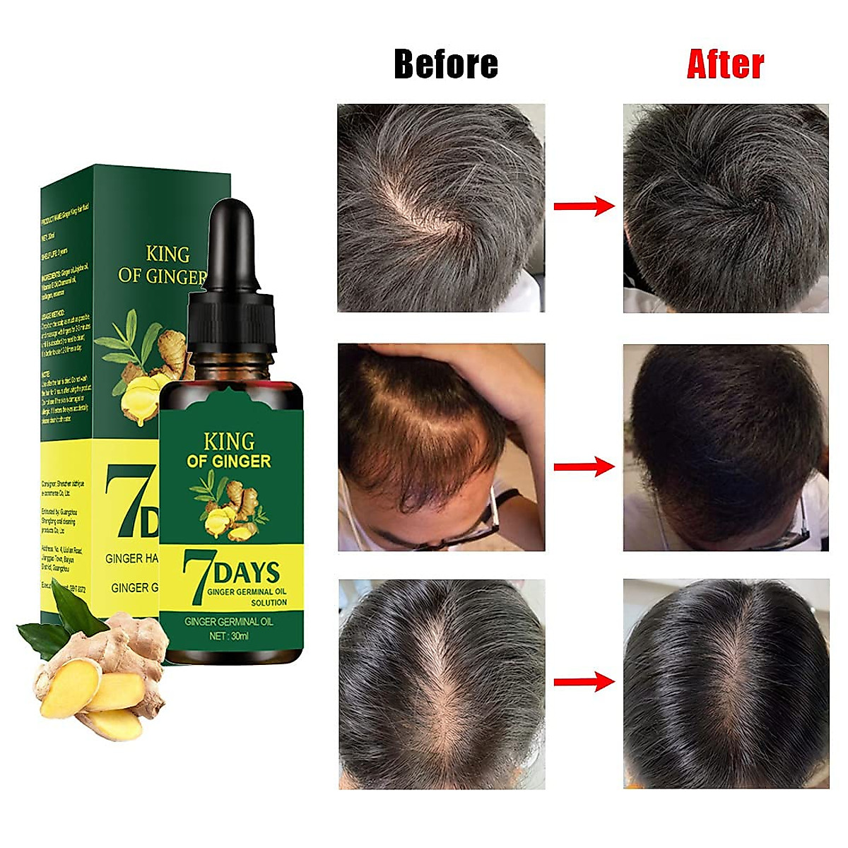 Ginger Hair Growth Germinal Oil, Regrow 7 Days Ginger Germinal Serum for Nourishing Hair Roots, 30ML (3pcs)