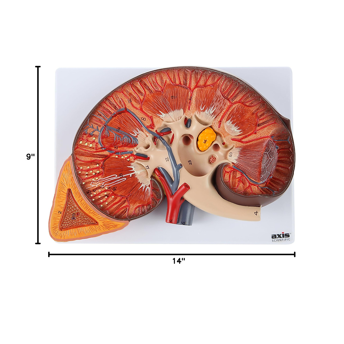 Axis Scientific Human Kidney Model | Anatomical Model is Enlarged to 3 Times Life Size | Includes Anatomy of Adrenal Gland and Nephrons | Includes Product Manual