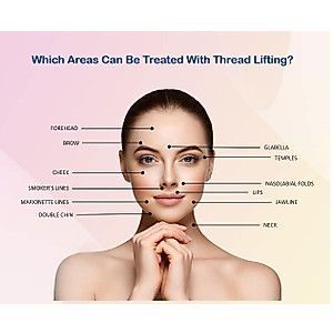 ACE - Multi Thread/L Cannular PDO thread for Forehead/Nose/Nasolabial Folds (23G38/50mm)