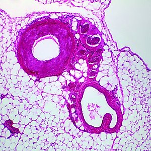 Mammal Artery & Vein C.S. 7 M H&E Microscope Slide