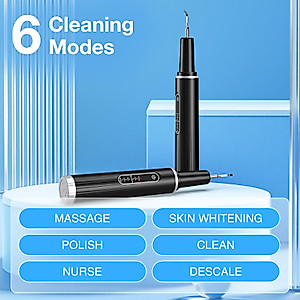 Oaknut Dog Tartar Remover for Teeth, Dog Teeth Cleaning, Dog Tooth Brushing Kit, Plaque Remover for Teeth, Teeth Cleaning Kit, Safe for Dog and Cat (Black, 8.46 in)