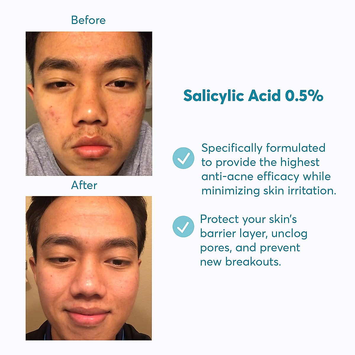 MDacne Hydrating Facial Cleanser with Micronized Salicylic Acid 0.5% - Acne Treatment with Plant-Based Ingredients to Remove Dirt & Oil, Protect Skin & Unclog Pores - Soothes Redness & Inflammation