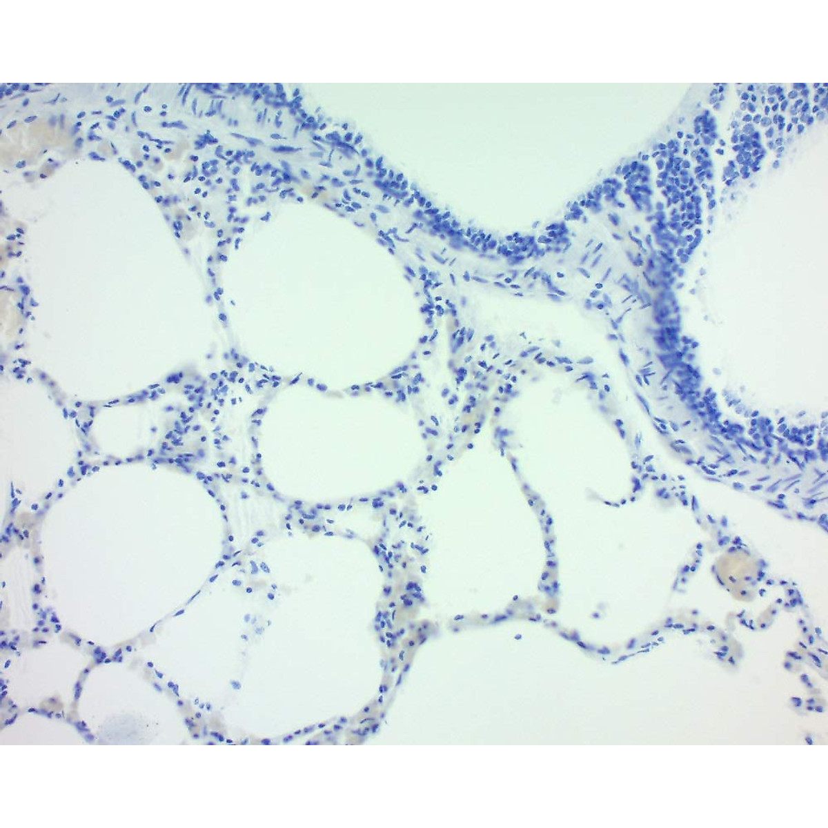 Hematoxylin, Mayer's (Lillie's Modification), 1000ml