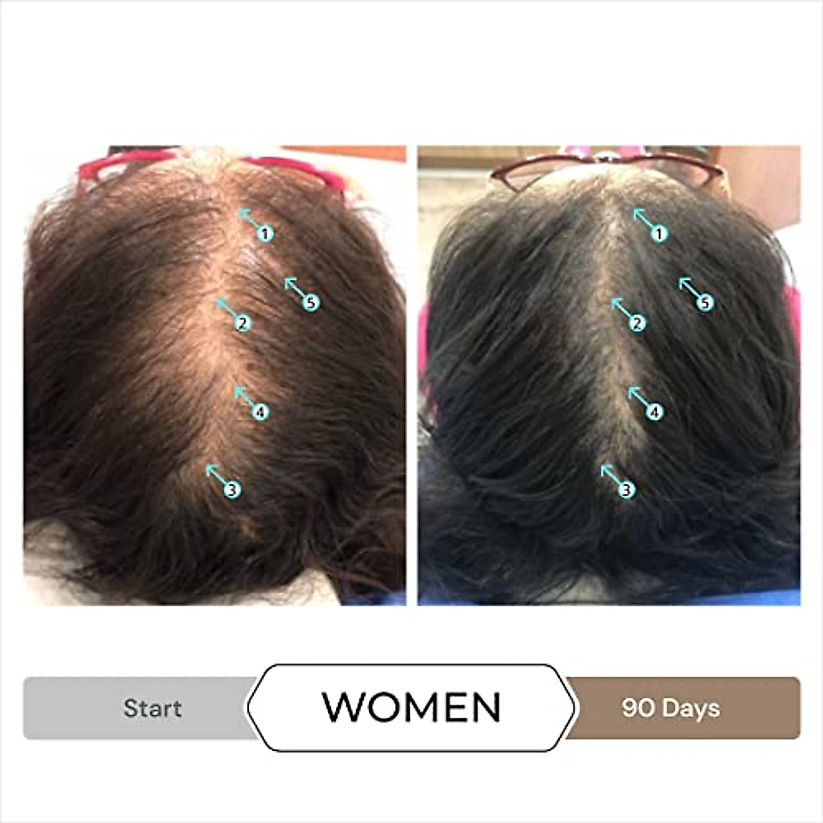 Spectral.DNC-N Leave In Serum to Support Hair Growth by DS Laboratories - Minoxidil Alternative for Men and Women, Experience Fuller, Thicker Hair, Water Based Formula 90 Day Supply (2 fl oz)