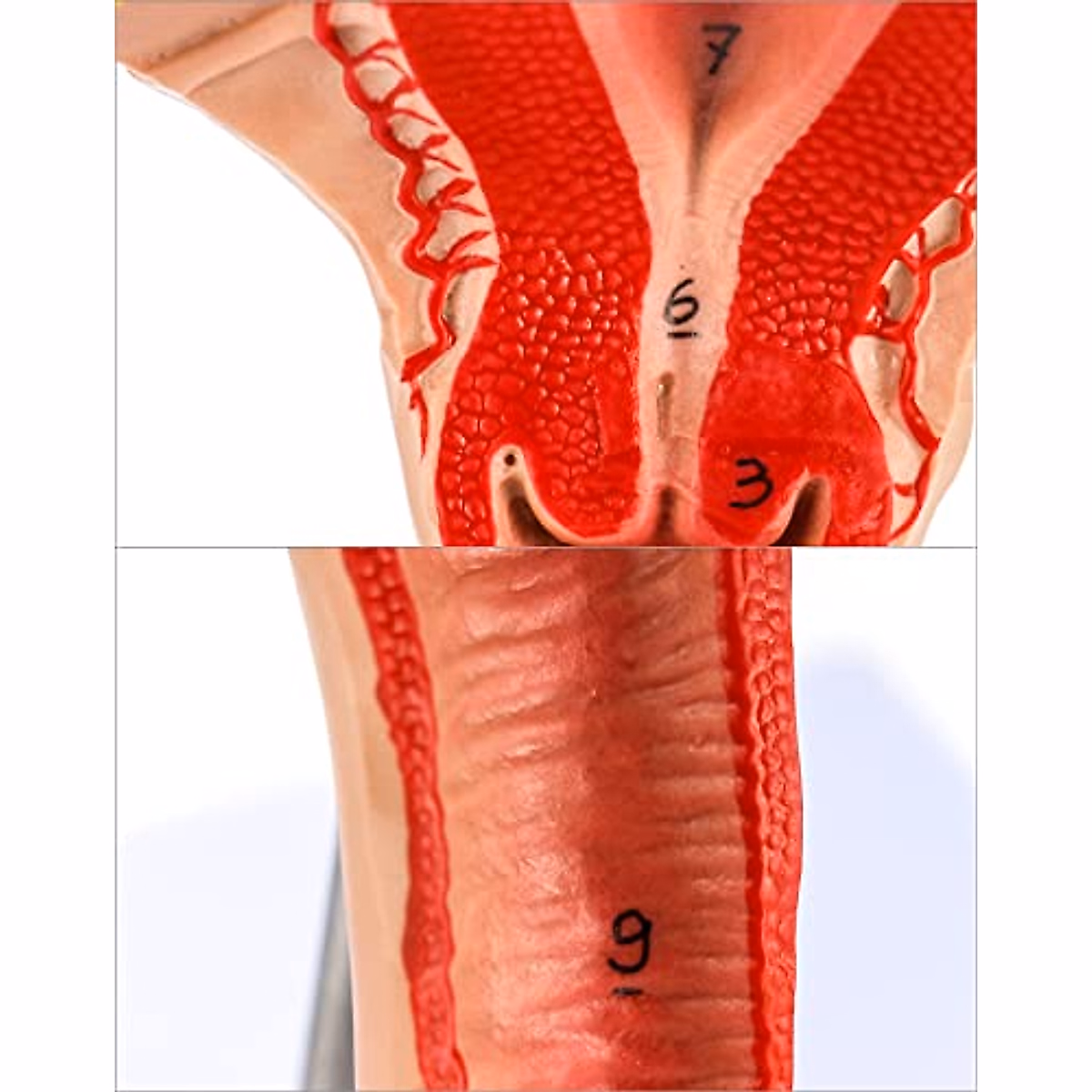 QWORK Human Female Uterus and Ovary Model, Female Genital Organ, Reproductive Organ Model, Uterine Medical Teaching Anatomical Gynecology Uterus and Ovary Model, Human Anatomy Replica