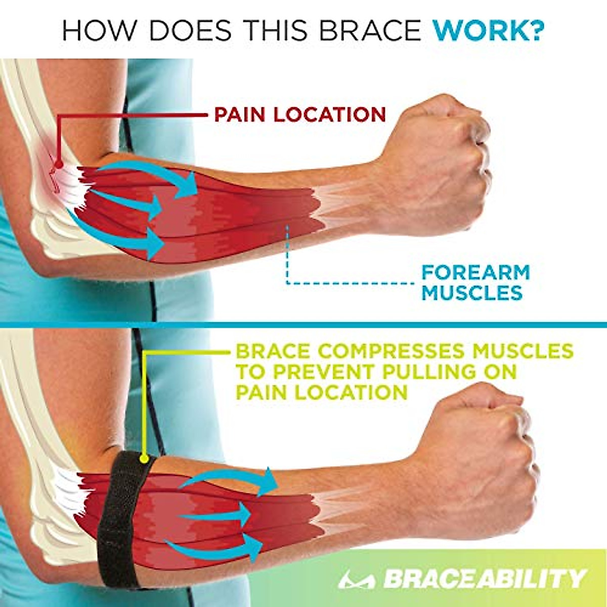 BraceAbility Epicondylitis Brace | Elbow Strap for Medial / Lateral Epicondyle Pain and Tendonitis Arm Compression Support Band for Men or Women (One Size Fits Most)