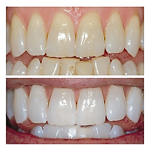 Vibe Teeth Whitening Pens, Healthy, Peroxide Free 4 Pack, Non-Toxic Fast Results, 3ml per pen, Vegan, Painless, teeth whitening kit for sensitive teeth, Travel Sized, Easy to Use, Organic Mint Flavor