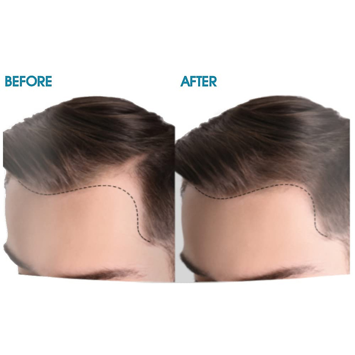 Difeel Mens Ultra Growth 2-in-1 Shampoo and Conditioner 12 oz. - Sulfate Free Shampoo & Conditioner for Men