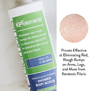 KP Elements Body Scrub (8 fl oz) | Keratosis Pilaris Treatment | Exfoliating Body Scrub and Body Moisturizer for Dry Skin | Helps Reduce Red Bumps | Body Skin Care Product for Men and Women