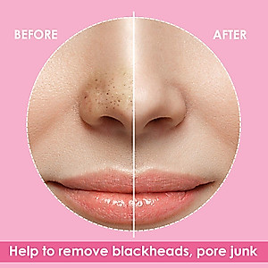 JOLVKA Blackhead Remover Pore Strips for Nose - 65 Strips - Charcoal Blackheads Removal - Blackhead Strip - Pore Cleaner