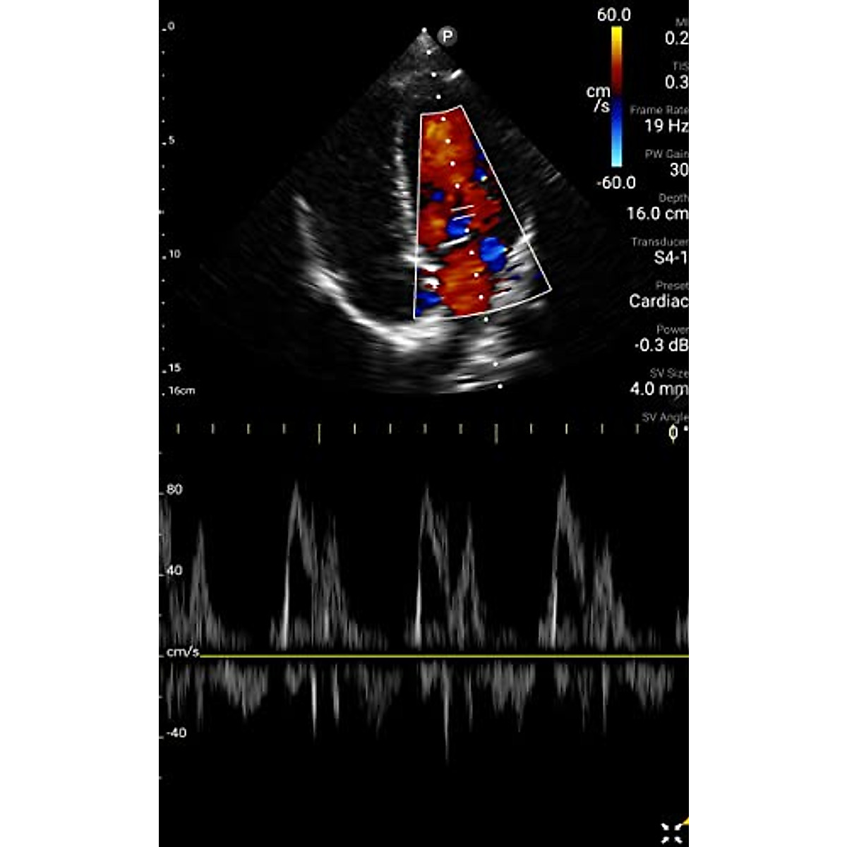 Philips Lumify S4-1 Phased Array Transducer, Portable Ultrasound Solution