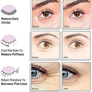 Under Eye Mask - Reduce Dark Circles, Puffy Eyes, Undereye Bags, Wrinkles - Gel Under Eye Patches, Vegan Cruelty-Free Self Care by grace and stella (48 Pairs, Blue)