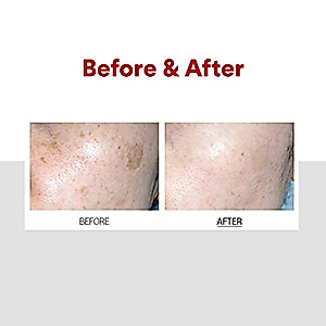 Medi-Peel, Melanon X Cream 1.01 fl oz | Help Reduce Dark Spots | Anti-Aging | Korean Beauty Skin Care | Spot Cream | Spot treatment | Brightning