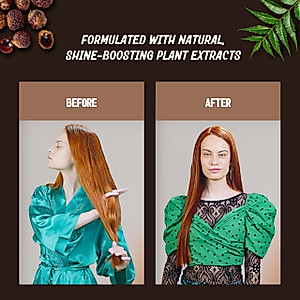 AyurVita Conditioner – Natural Nourishing Dandruff Conditioner – Hair Care with Neem & Reetha – Ayurvedic Daily Hydrating Conditioner - Moisturizing Cleansing Conditioner –For Women & Men - 10 fl oz