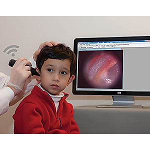 Firefly DE550 Wireless Digital Video Otoscope/Earscope