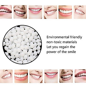 EXCEART 100g Plastic Thermal Adhesive Beads for Tooth Repair, Custom Grip, Model Making