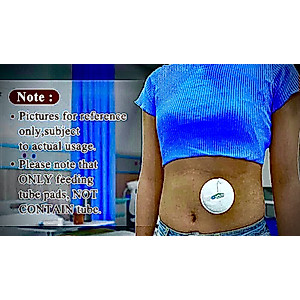 Cutie Button Pads G/j Tube Pad 10 Pack (Boy Mix)