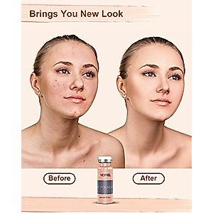 VOFEL BB Glow Starter Kit BB Glow Pigment for Skin Treatment Kit 5 Shades 10 Vials 5ML