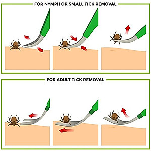 TickCheck Premium Tick Remover Kit - Stainless Steel Tick Remover + Tweezers, Leather Case, and Free Pocket Tick Identification Card (1 Set)