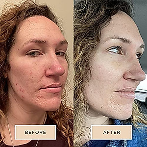 Averr Aglow - No.2 Radiant Cleansing Nectar - Rinse-Free Anti-Aging Daily Face Wash - Fights Acne, Breakouts, Blackheads & Blemishes - Plant & Mineral Based - For Men & Women - 4fl oz / 120 ml