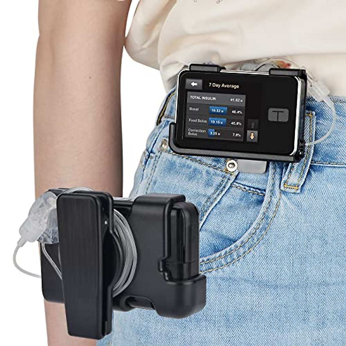 (Upgrade) iGuerburn tSlim X2 Pump Case with 360°Rotating Clip, Tandem tSlim Pump Holder Spool Up Excess Tubing, t Slim G4 Pump Accessories t:Holster Smooth Edges Won't Peel Off Screen Cover(Black)