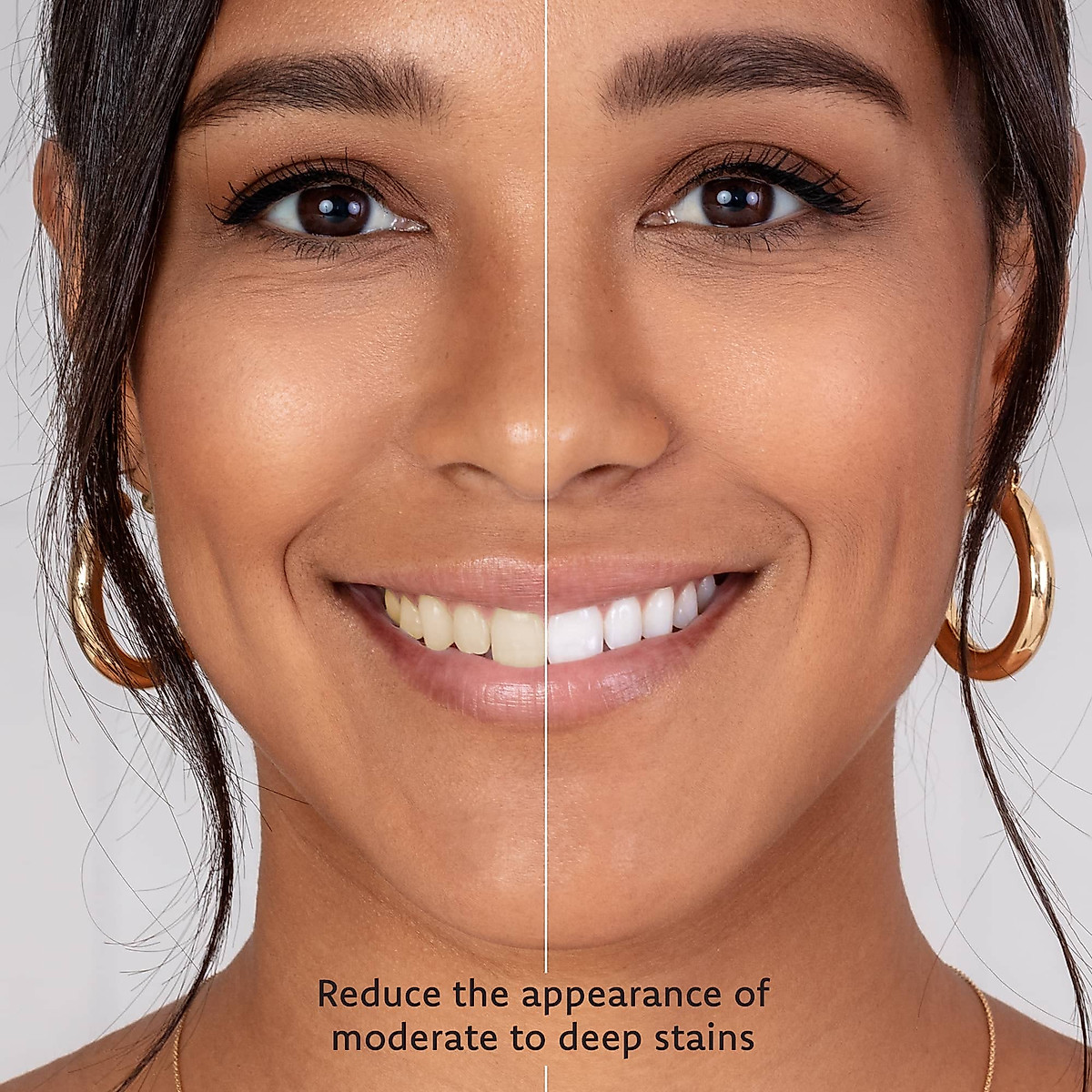 Teeth Whitening Gel for Trays, 4 Take Home Syringes, 35% Carbamide Peroxide, with Potassium-Nitrate, Trays Not Included, USA Made, Teeth Whitening Kit by Everest VAAS