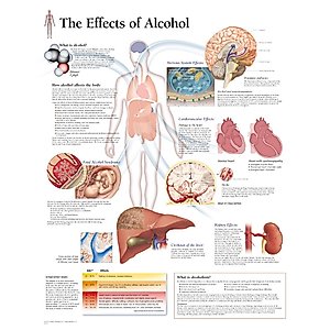 The Effects of Alcohol chart: Wall Chart