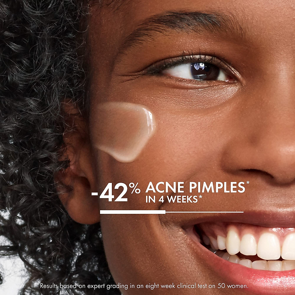 Vichy Normaderm Acne Control Daily Moisturizer, Acne Moisturizer For Face, 2% Salicylic Acid + Hyaluronic Acid + Vitamin C, Acne Treatment For Blackheads, Acne Blemishes & Enlarged Pores, Oil Free