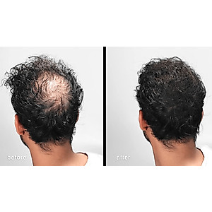 LUXE Hair Thickening Fibers - CONFIDENCE IN A JAR – 2 Months+ Supply! – Hypoallergenic, Dermatologist Tested – Multiple Colors Available (Dark Brown)