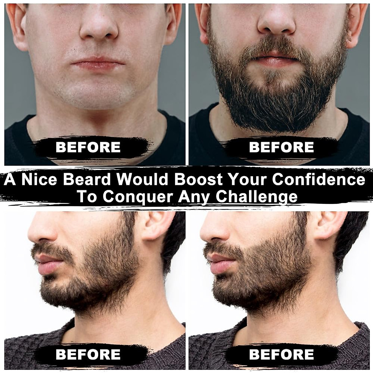 Beard Growth Kit,Fathers Gifts for Men Dad Husband W/Beard Derma Roller,2 Pack Beard Oil,Beard Serum,Wash,Balm,Brush,Comb,Scissor for Beard Grooming Care,Christmas Stocking Stuffers Nail Art Fimo