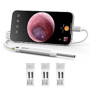 Anykit Digital Otoscope with Gyroscope, HD Ultra Clear View Ear Camera with Ear Wax Removal Tools, Video Ear Scope Otoscope with Light, Compatible with Android, iPhone 15 (Silver)