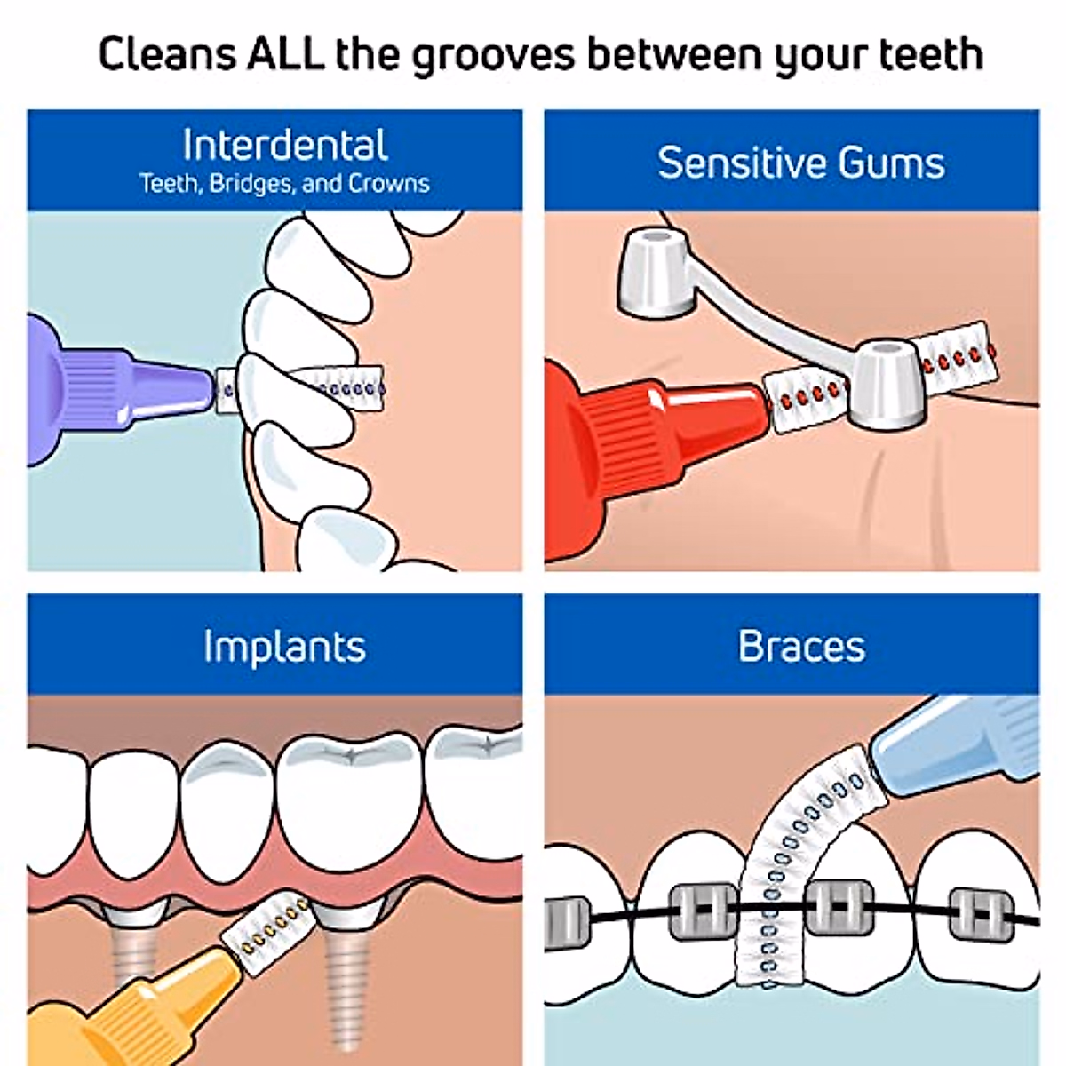 TEPE Interdental Brush Extra Soft, Supersoft Dental Brush for Teeth Cleaning, Pack of 8, 1.1 mm, Large Gaps, Purple, Size 6