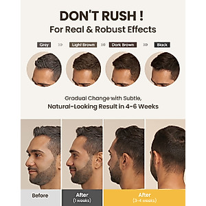 MODA Pro-Change Black Shampoo | Korean Hair Darkening, Volumizing & Anti-Hair Fall Shampoo | Paraben & Sulfate Free, Natural Formula for Thicker, Fuller Hair (10.5 oz)