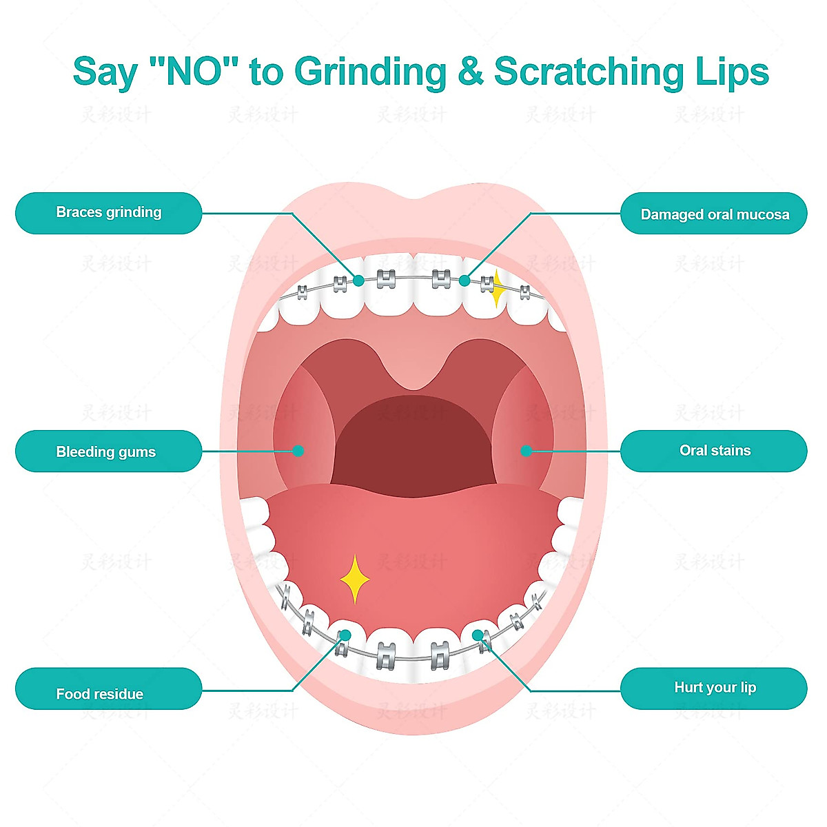 Annhua Orthodontist Wax Brace Wax Flavored 10 Pack, Dental Ortho Dots Wax Strips for Aligners, Braces Wearer, Brackets, Invisible-lingers, 10 Fruit Smell