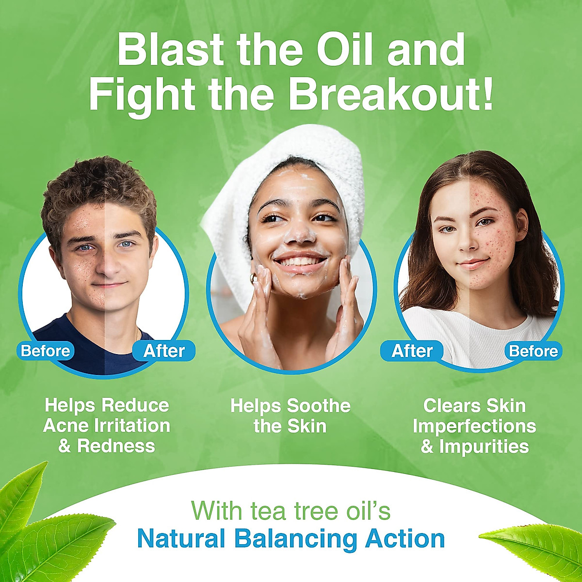 Kidskin T-Blast Facial Cleanser, Gentle Face Wash with Tea Tree Oil, Spot Skin Care for Kids and Teens, Non-Drying Natural Cleanser for Oily or Dry, Acne-Prone Skin, 150 ml 5.0 fl oz.