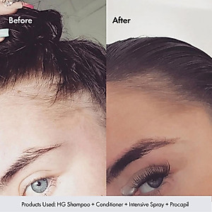 BondiBoost Procapil Hair Tonic 4.23 fl oz - Leave-In Treatment for Thinning Hair - Reduce Hair Fall + Increase Hair Density - Lightweight Non-Greasy Formula - Vegan/Cruelty-Free - Australian Made