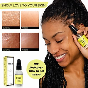 BHA 7% Salicylic Acid Serum Daily Exfoliant Acne Treatment Clearing Gel for Blackheads, Zits, Oily Skin, Dark Spot Treatment, Anti Aging, Face Blemishes, Pimple Treatment 1 oz - Divulge Beauty