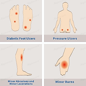 Algitocare Ag Silver Calcium Alginate Wound Dressing - 4"x4"(Pack of 5), Non-Stick Sterile Gauze Pads for Accelerating Wound Healing, High Absorbency and Soft for Wound Care Supplies …