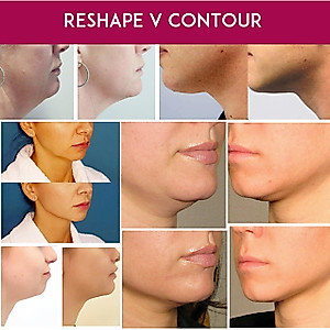 Anacis Advanced Neck Under Chin Mask Works for V-line Neck Chin Jawline - Fine Lines - Neck Wrinkles - Sagging Skin - For Women and Men. (5 Double Masks)