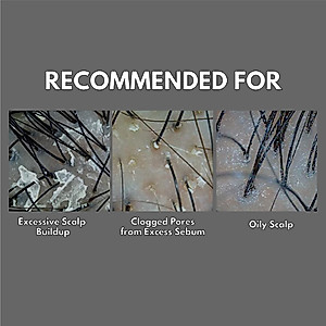 LA'DOR Anti-Dandruff Shampoo (16.9 fl.oz.) - For Oily Scalp with Dandruff, Gently Cleanses Away Dead Skin Cells, Alleviates Itching and Irritation LADOR