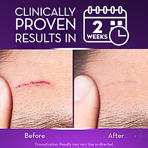 Cicatricure Scars Gel 1oz Tube Multipack Value Deal Pack of 3 Tubes