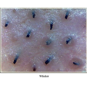 Firefly DE350 Wireless Polarized Handheld Digital Dermatoscope/Microscope