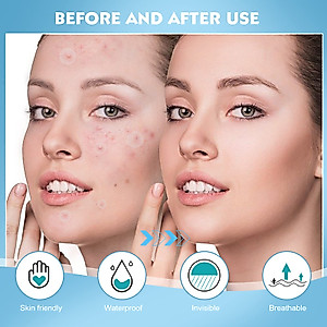 Soonuly Pimple Patches for Face - 180 Hydrocolloid Acne Pimple Patches Salicylic Acid with Tea Tree Oil for Zit Blemish Spot Covers Invisible Pimple Stickers Not Tested on Animals