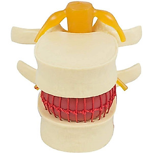 1PCS Anatomical Human Lumbar Vertebrae Degenerative Lumbar Human Spine Model (Yellow)