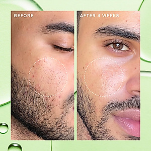 Farmacy 2% Salicylic Acid Toner for Face - Deep Sweep Gentle BHA Exfoliant for Oily Skin - Refines Texture with Papaya Enzymes & Moringa Water for a Healthy-Looking Complexion (120ml)