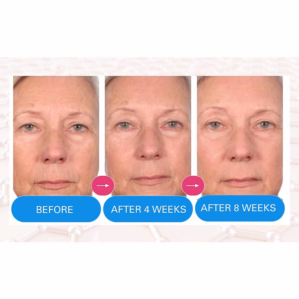 Serious Skincare - Dr. Mark Pinsky - Trace + Erase Needle Free Wrinkle Filler - Fills Visible Deep Lines, Wrinkles and Creases - Helps Restore Skin's Elasticity and Tone - Face and Neck 1 Fl Oz