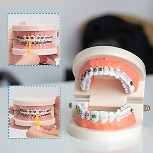 OBTANIM 100 Pcs Colorful Disposable Plastic Braces Elastic Rubber Bands Placers Tool for Braces Dental Orthodontic